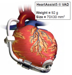 CFD Characterization of the Ventricular Assist Device HeartAssist 5 ...